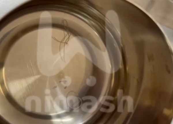 Нижегородец несколько месяцев ходил с 11-сантиметровым червём в щеке 5 ...